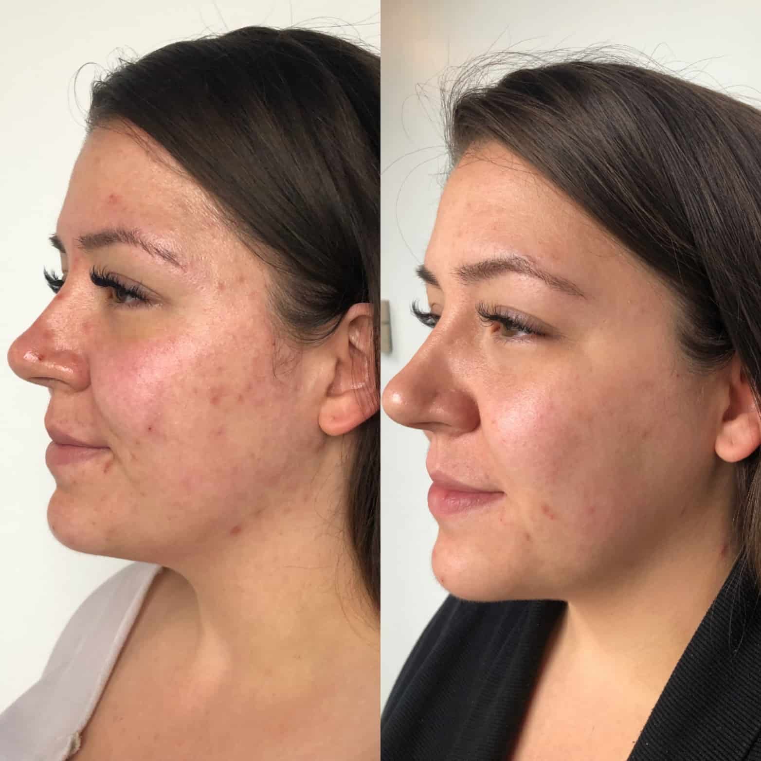 Dermalounge MediSpa & Laser Clinic Giveaway + Final Results - Modern Mama