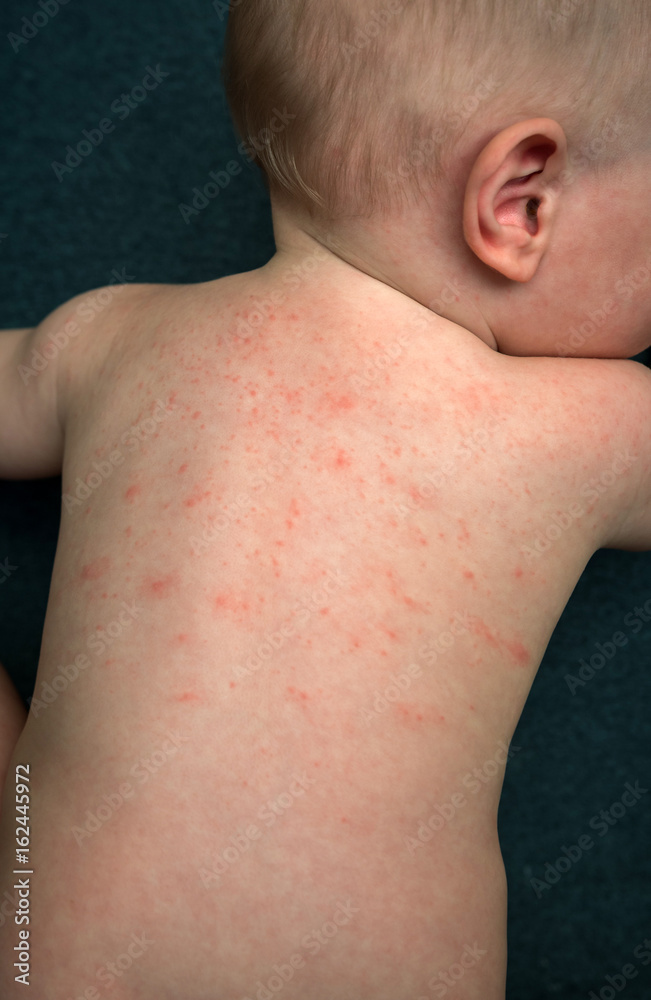 First Aid Every Parent Should Know - Modern Mama
